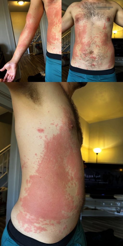 HOME - poison-ivy.org